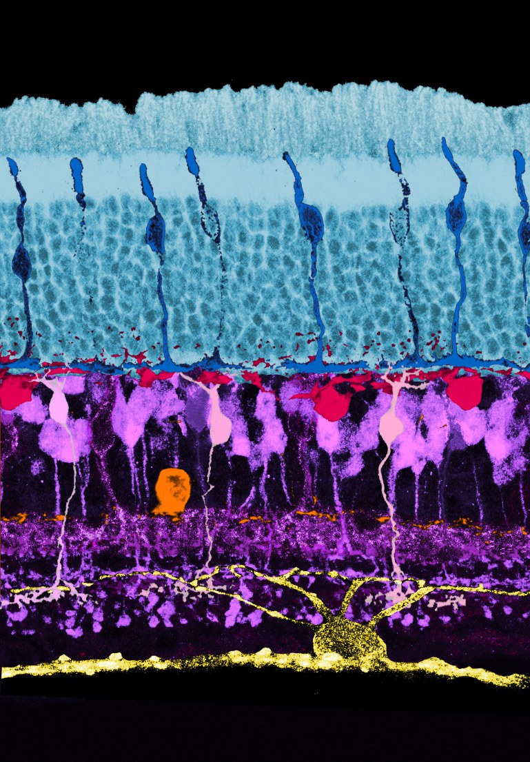 LFG%20Mol%20Sinn%20Neuro%20Prof%20M%C3%BCller%20-%20kombinierte ...