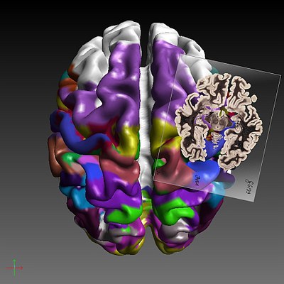 brainmap_450.normal.jpeg