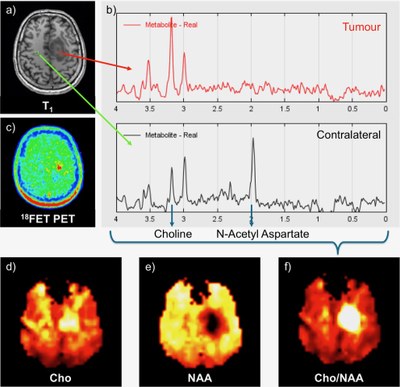 MRI Spectroscopy
